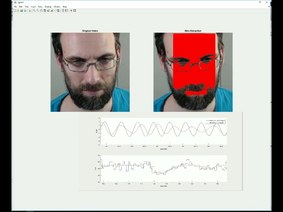 Remote Heart Rate Detection from Frontal Face Videos | Chen Wang